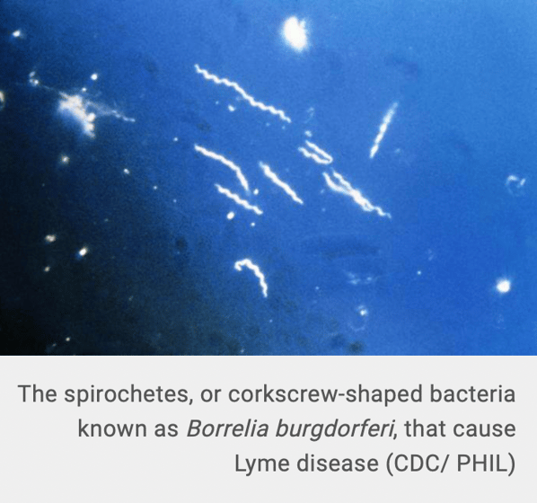 New Funding to Help University of Guelph Scientists Probe Lyme Disease ...